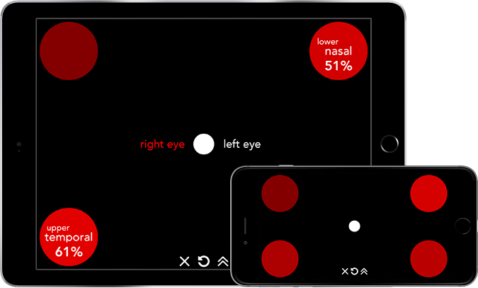Red Desaturation – Smart Optometry